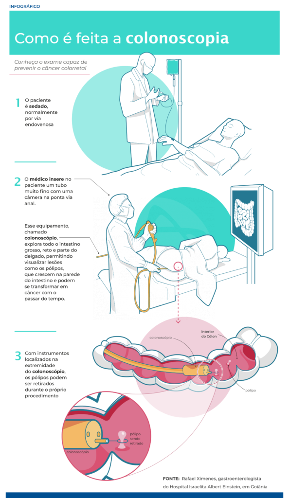 Saiba como se preparar para a colonoscopia - ISTOÉ Independente